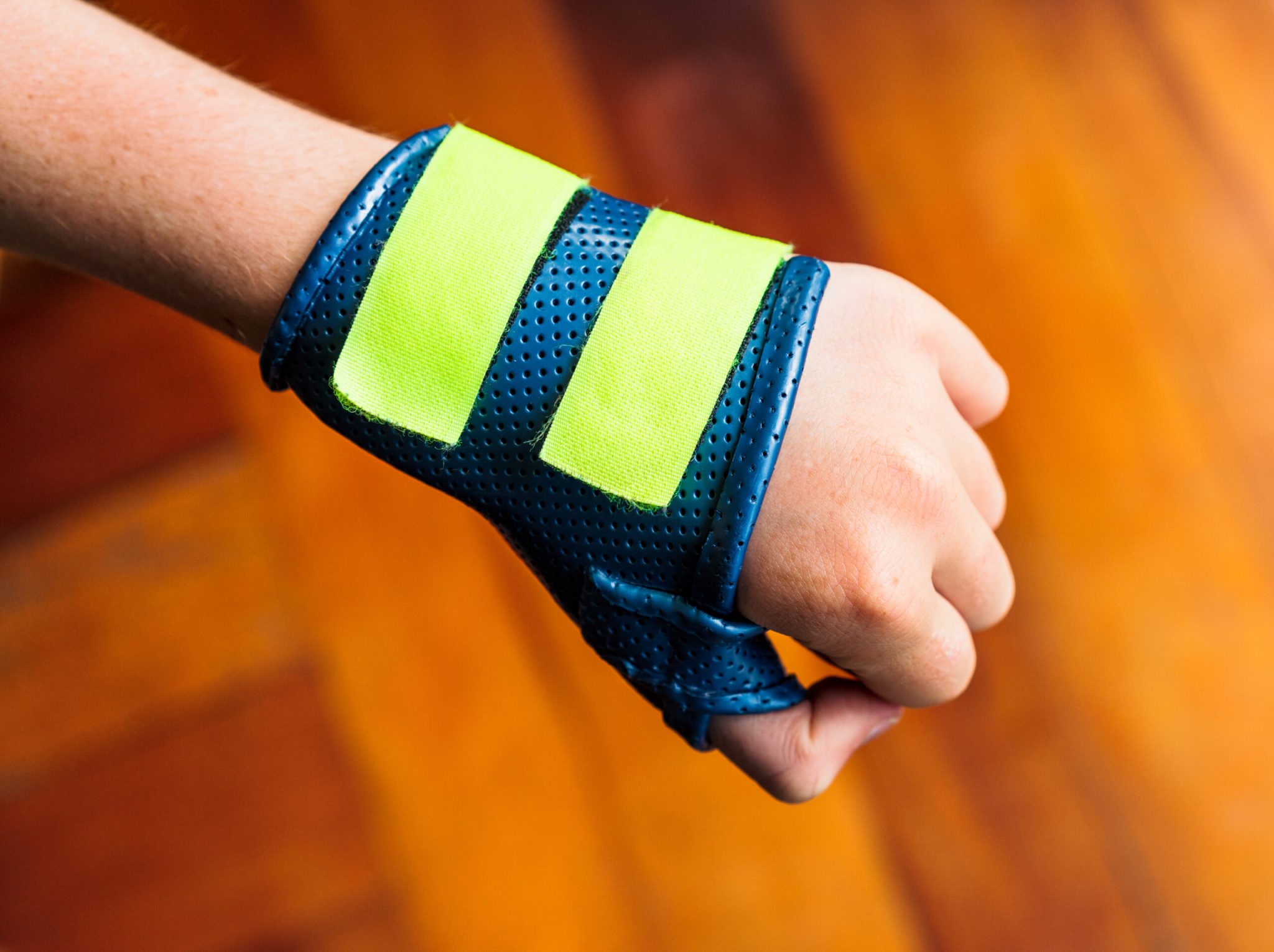 Customized Orthotic Devices & Splint Solutions From Synergy Health