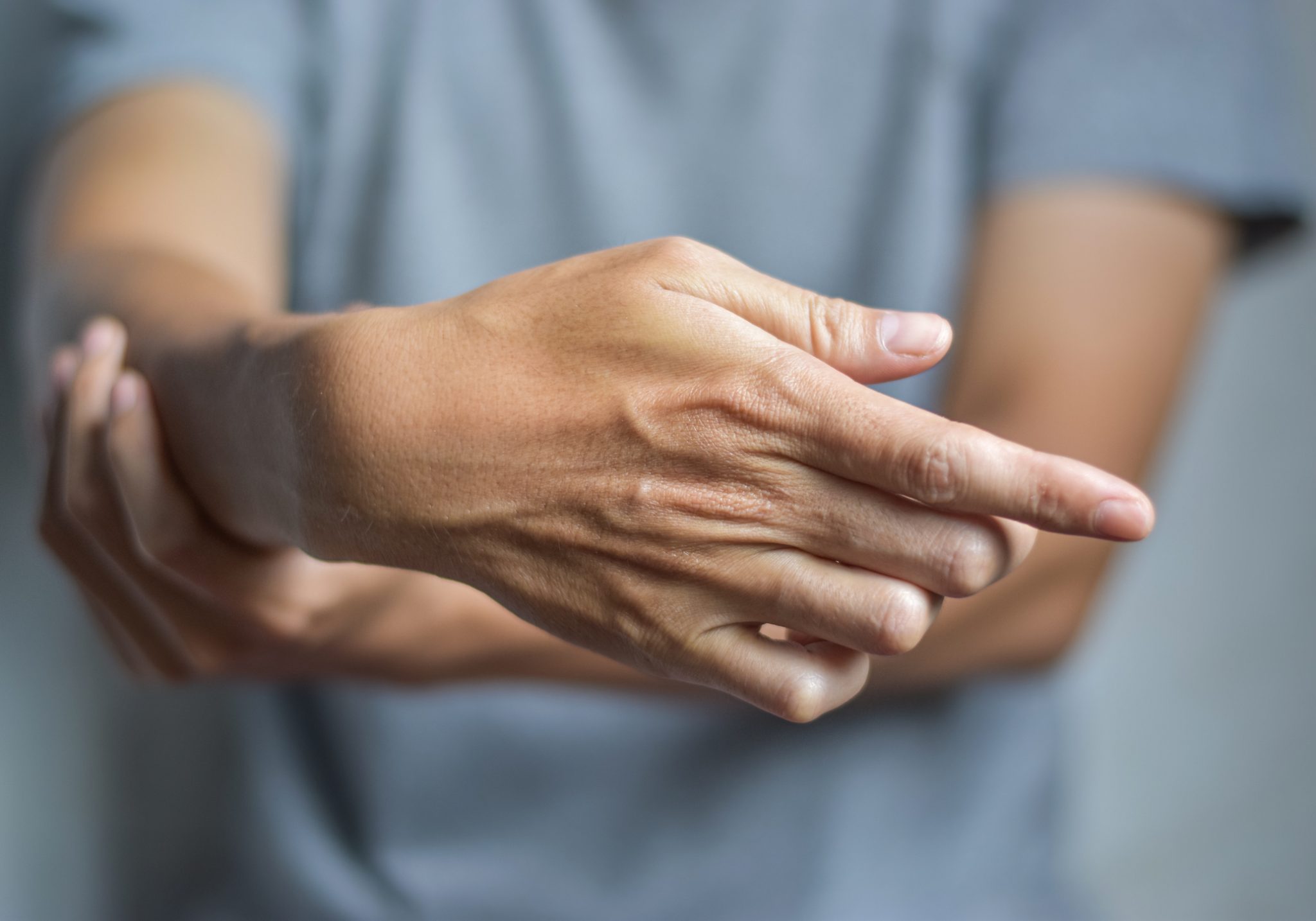Dupuytren Contracture Release | Synergy Health Partners