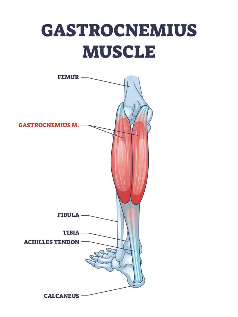 Gastrocnemius Recession | Synergy Health Partners