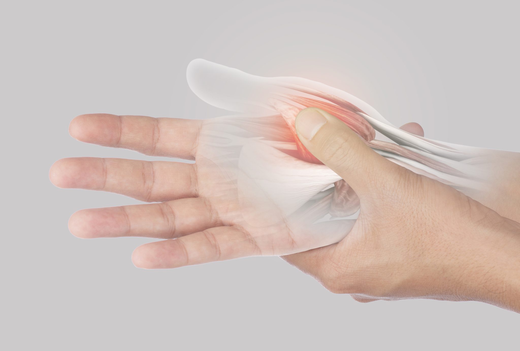 Tendon Repair | Synergy Health Partners