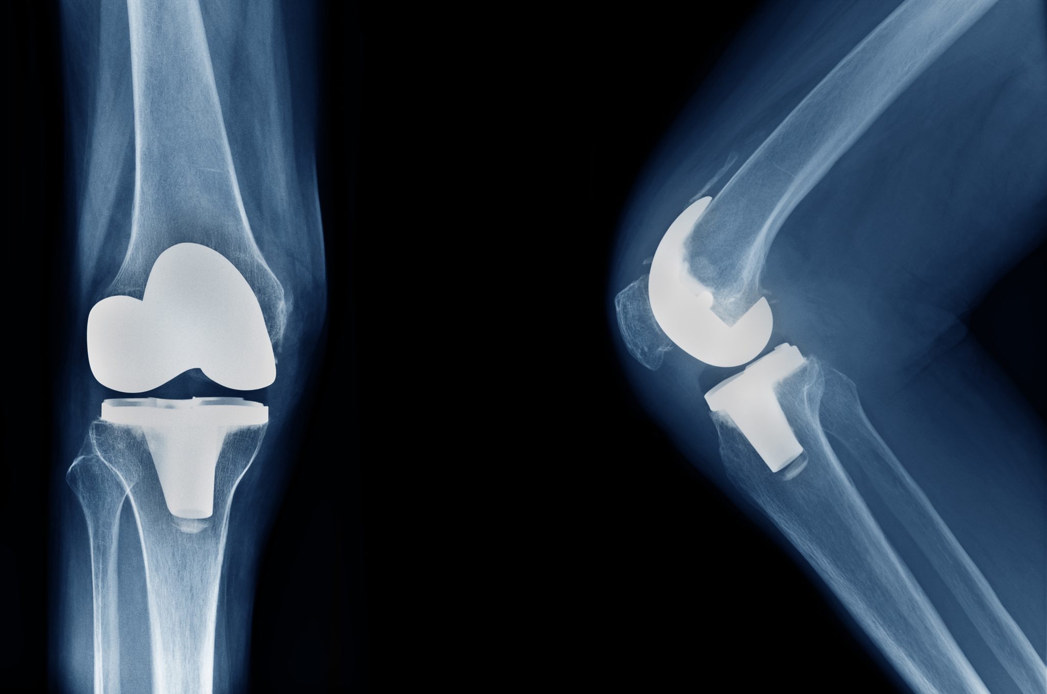 Explore Expert Post-Surgery Orthopedic Care | Synergy Health Partners