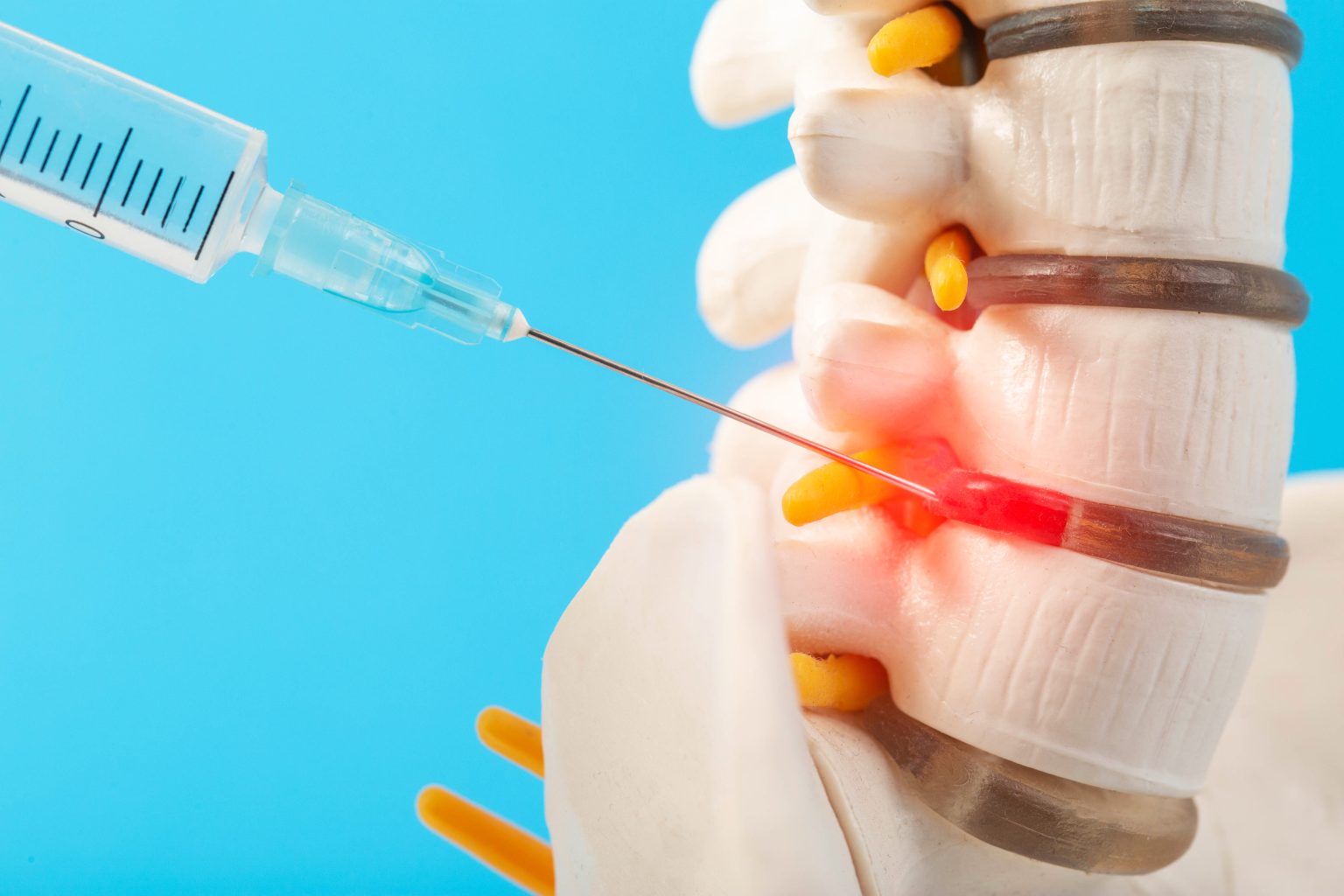 Peripheral Nerve Injection - Synergy Health Partners